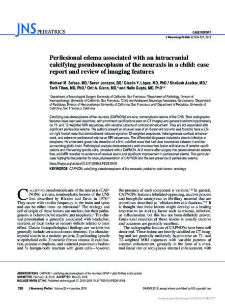 Perilesional Edema Associated With an Intracranial Calcifying ...