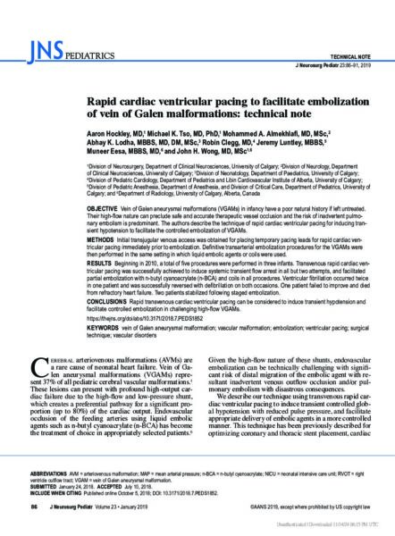 Rapid cardiac ventricular pacing to facilitate embolization of vein of ...